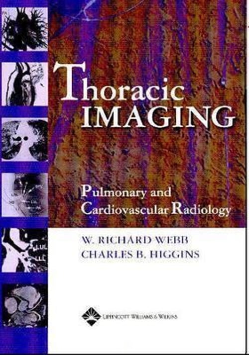 Pre-Owned Thoracic Imaging: Pulmonary And Cardiovascular Radiology (Hardcover) 078174119X ...