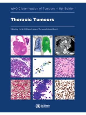 Thoracic Tumours: WHO Classification of Tumours - Walmart.com