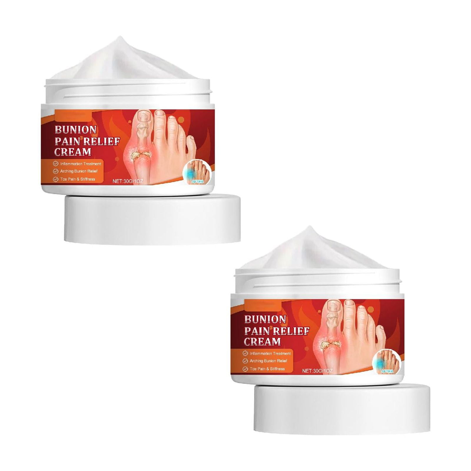 Thumb Bursitis Ointment For Repairing And Correcting Thumb Eversion ...