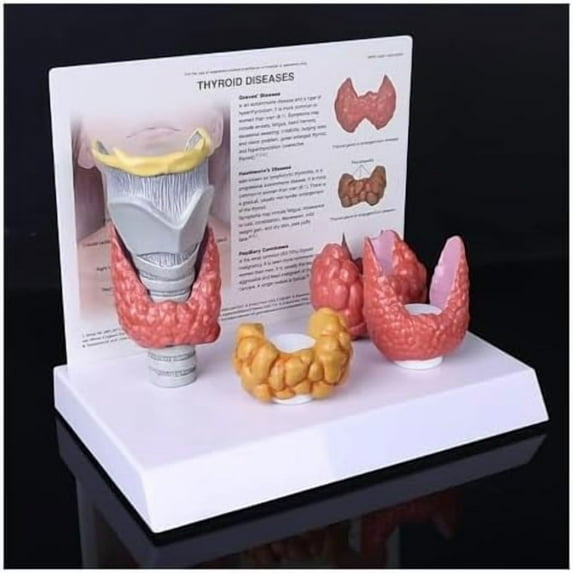 Thyroid Anatomy Model - Thyroid Nodule Model,3:1 Showing The Thyroid ...