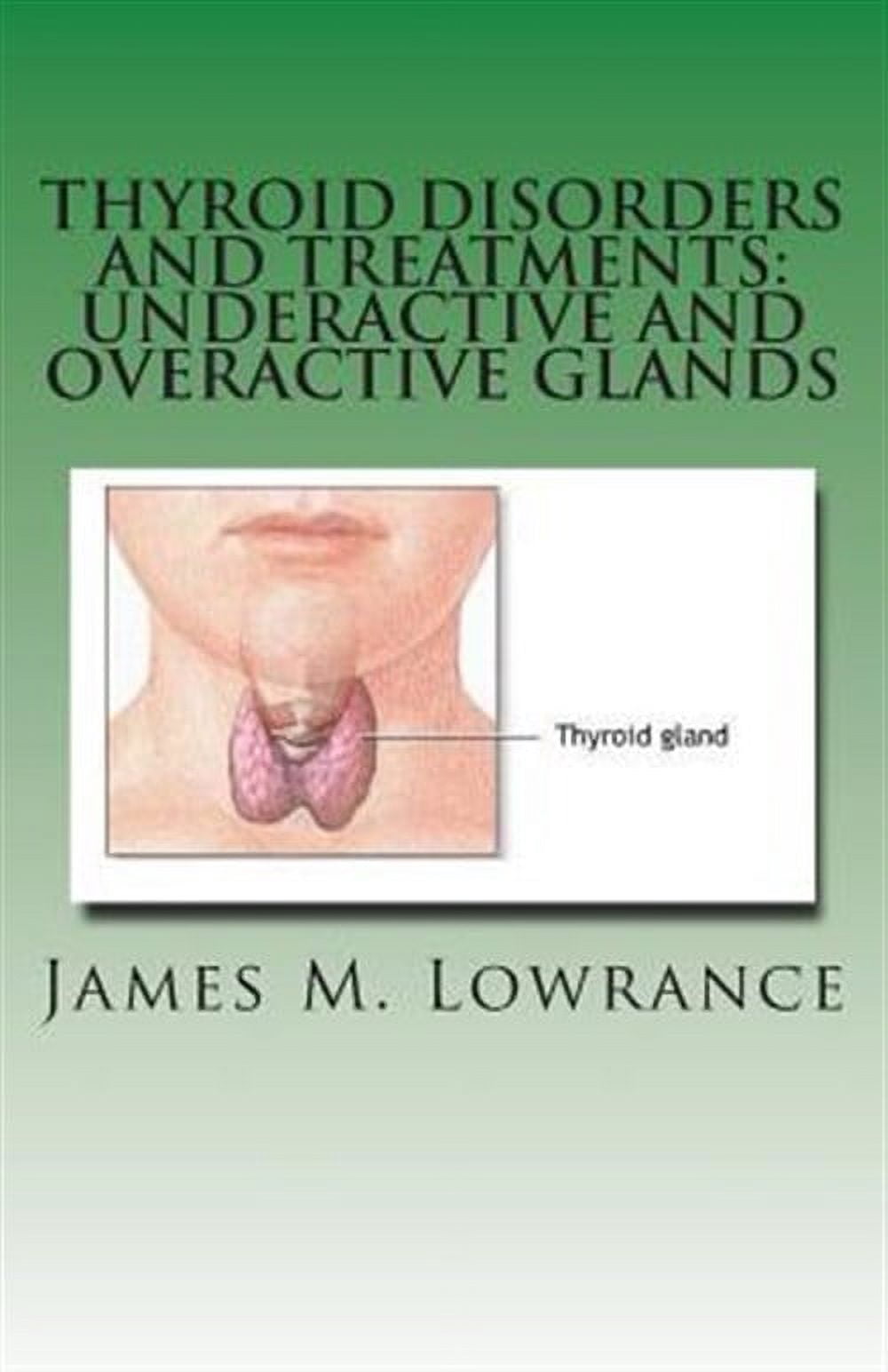 Thyroid Disorders and Treatments : Underactive and Overactive Glands ...