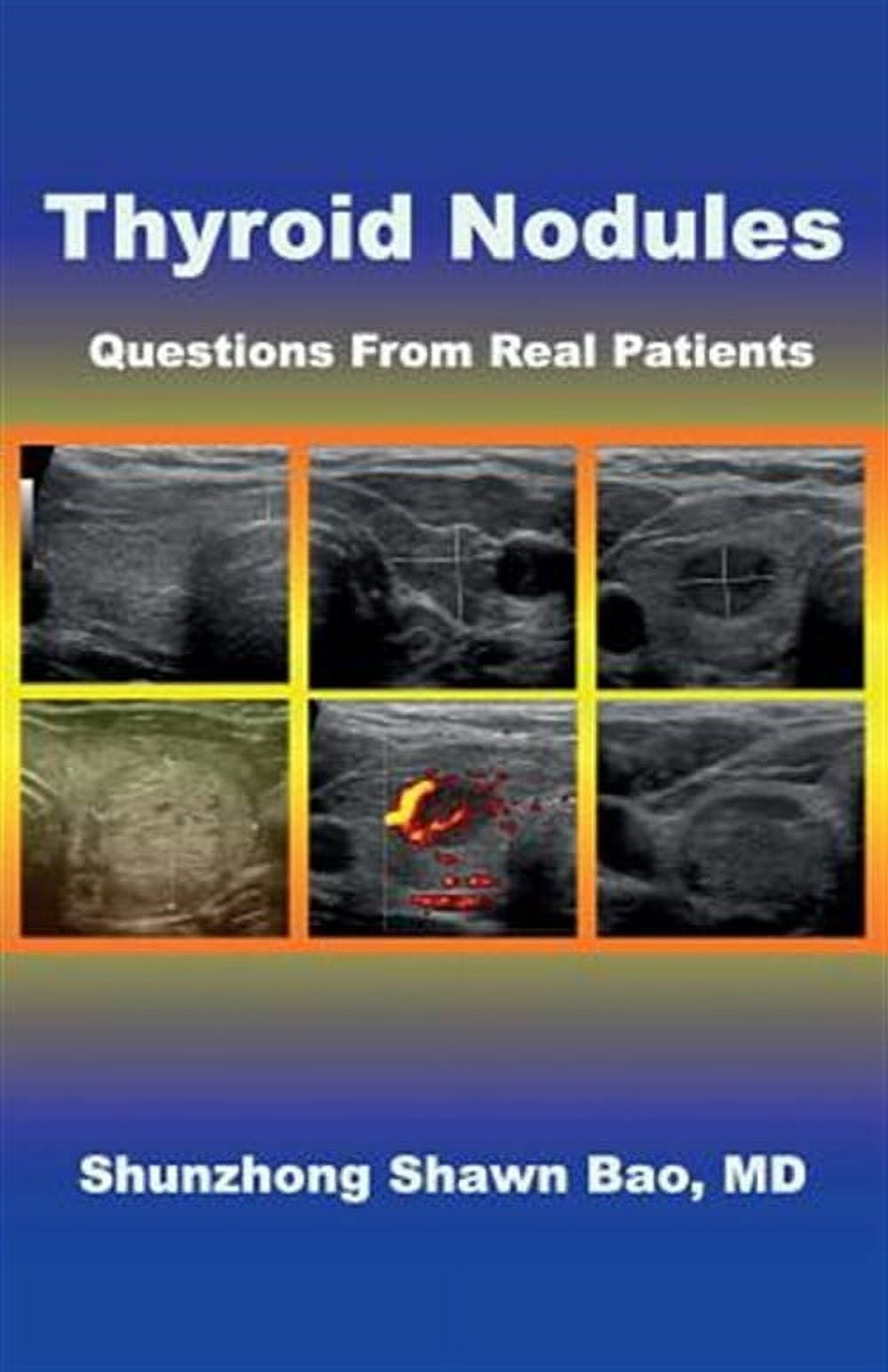 Thyroid Nodules: Questions from Real Patients - Walmart Business Supplies