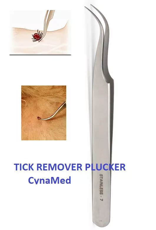 Tick Removal Forceps (Tweezers) - Professional Quality Tick Removal ...
