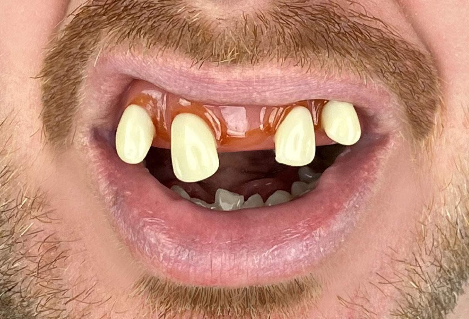 Tiger Teeth, Every Smile is Exotic! - Walmart.com