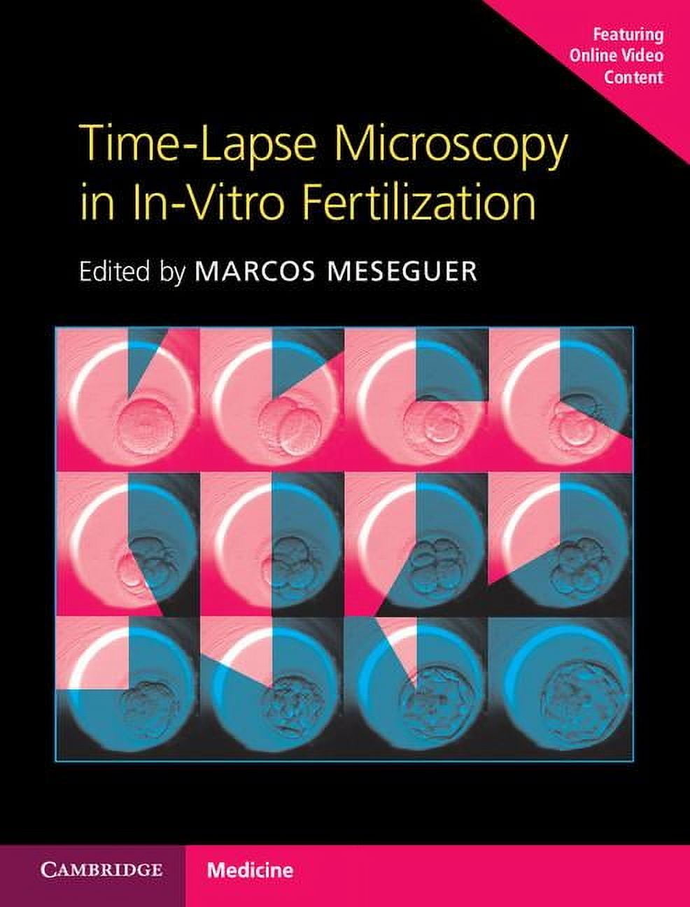 Time-Lapse Microscopy in In-Vitro Fertilization, (Paperback) - Walmart.com