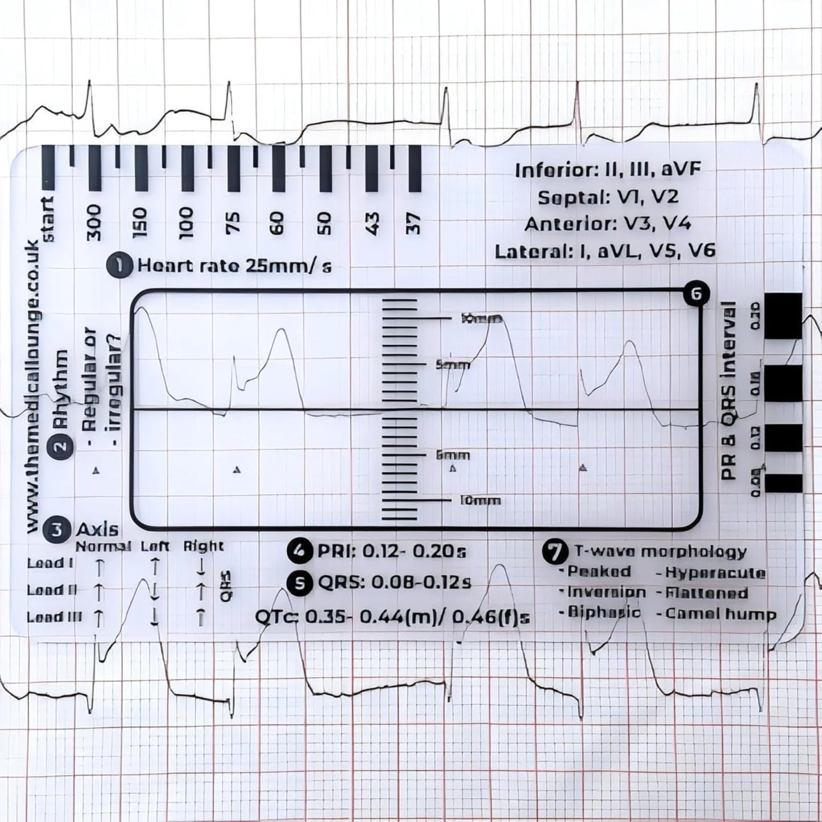Tingzi ECG 7 Step Ruler, ECG/EKG 7 Step Ruler Card for ECG/EKG ... Tingzi ECG 7 Step Ruler, ECG/EKG 7 Step Ruler Card for ECG/EKG ...