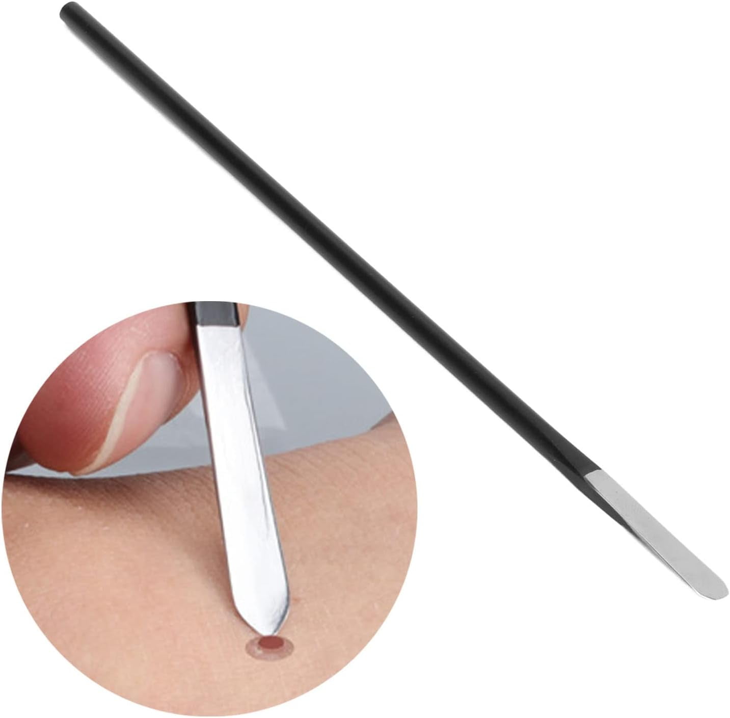 Tingzi Facial Peels Stainless Steel Wart Removal Pedicure Knife ...