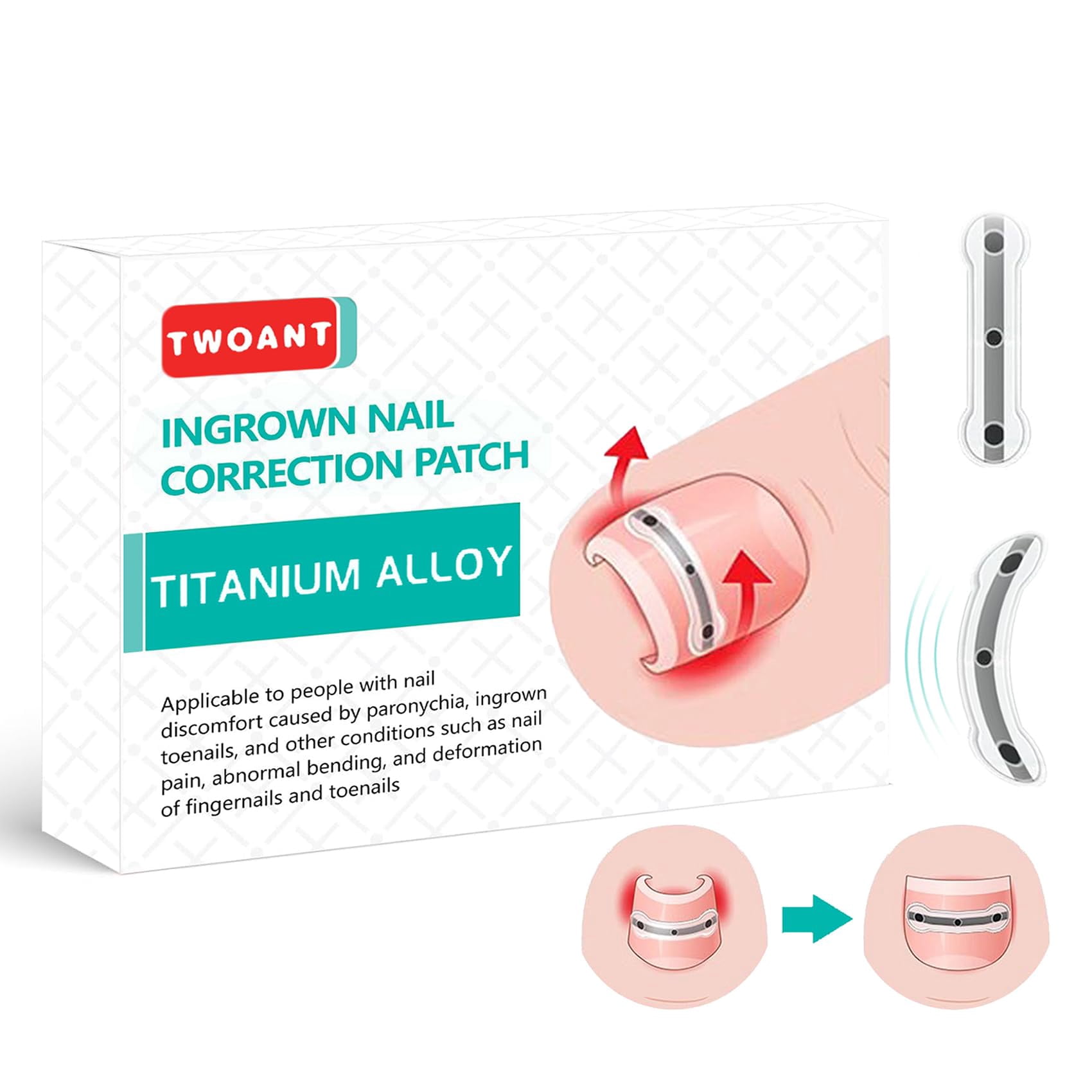 Titanium Alloy Ingrown Toenail Treatment, Ingrown Toenail Removal Kit ...
