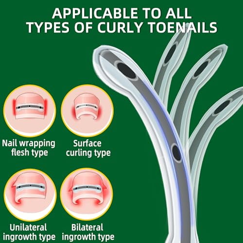 Titanium Alloy Ingrown Toenail Treatment & Removal Kit for Quick Relief ...