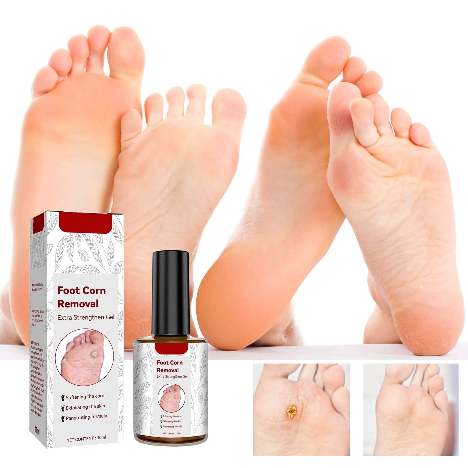 Tkrady Foot Corn Removal Extra Strengthen Gel, Liquid Corn and Callus ...