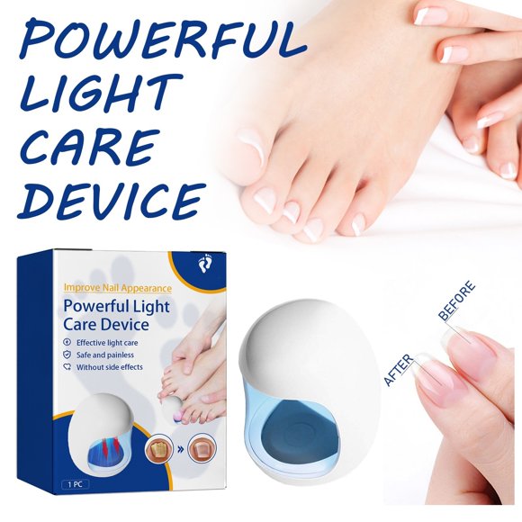 Fungal Toenail Laser Treatment