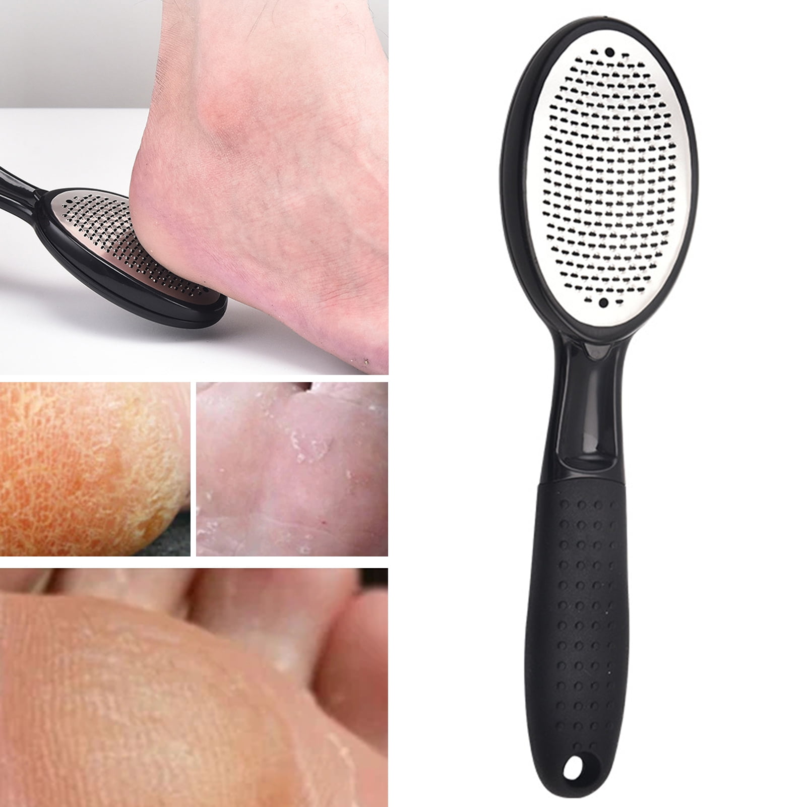Tnobhg 1 Set Foot Callus Remover Kit Professional Stainless Steel Foot ...