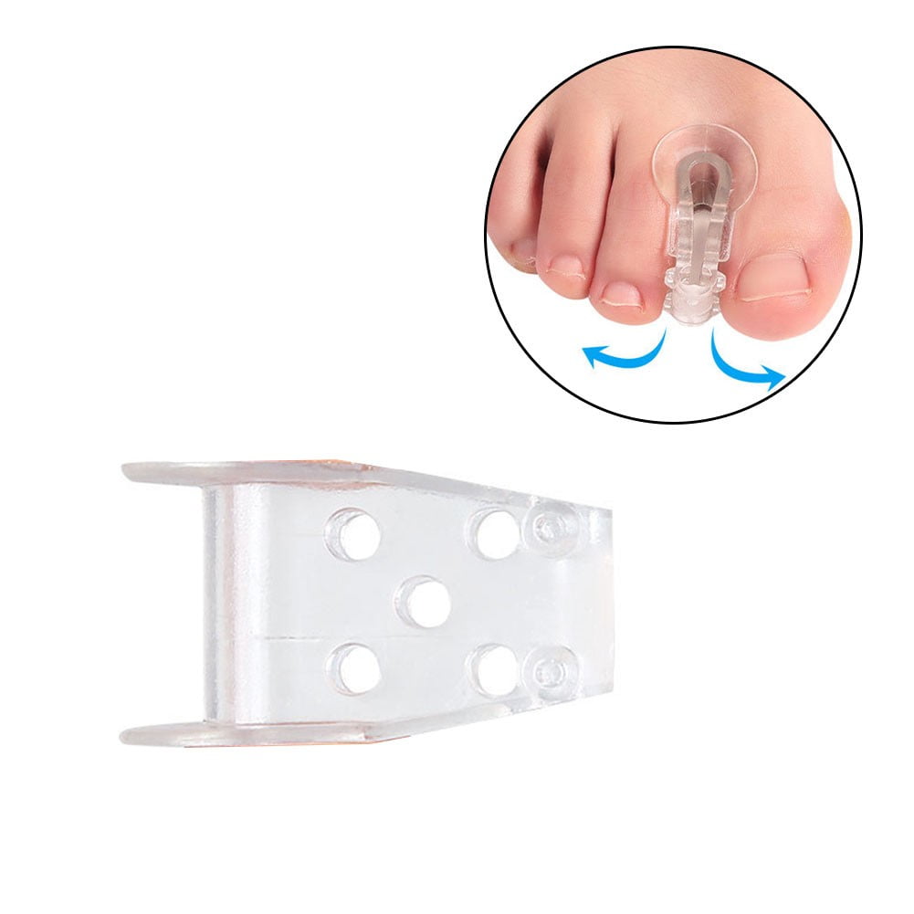 Toe Splitter Thumb Outer Turntormor Foot Bone Orthosis Toe Overlap ...