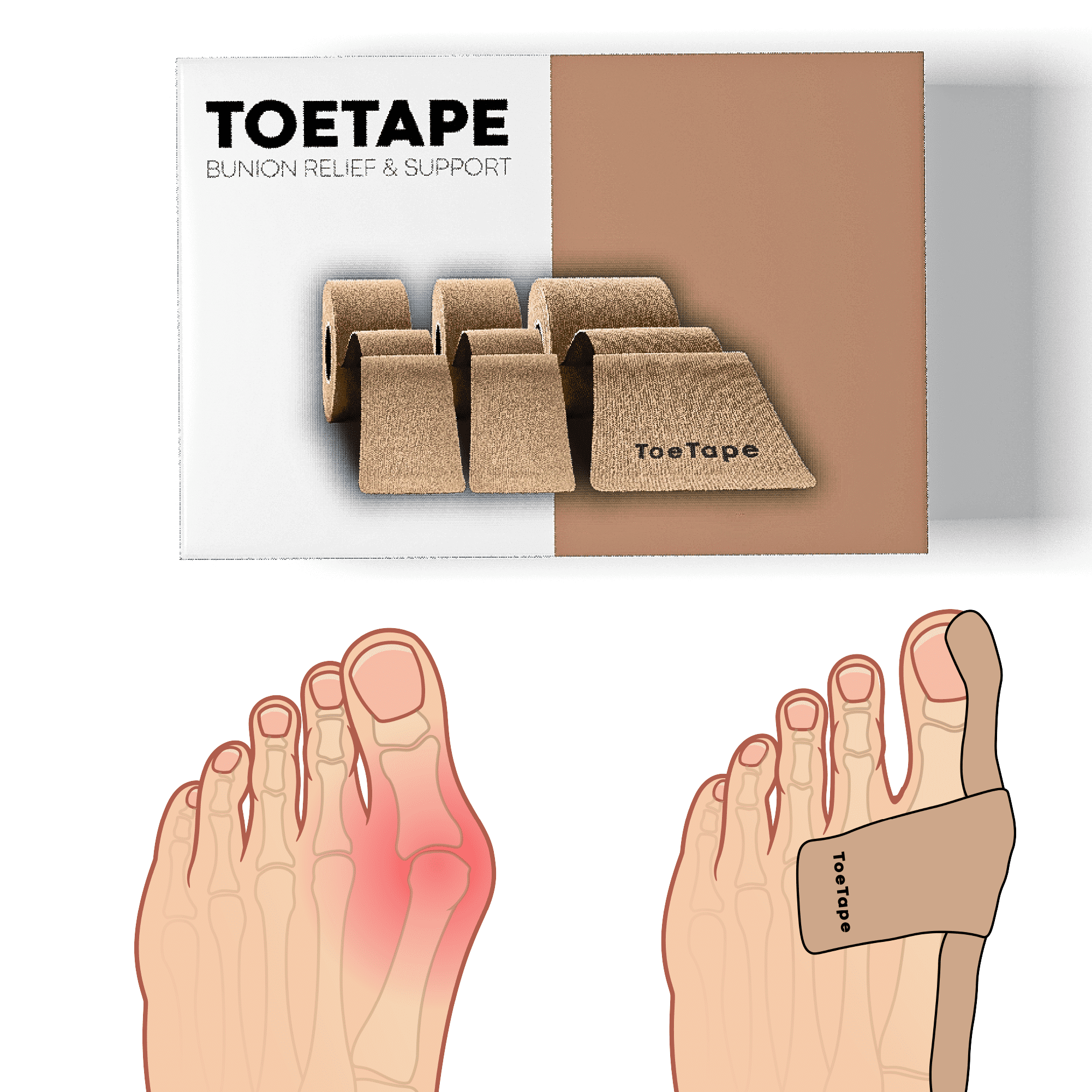 ToeTape - Bunion Correction & Pain Relief Tape | 40 Count | Precut Kinesiology Tape for Bunions ...