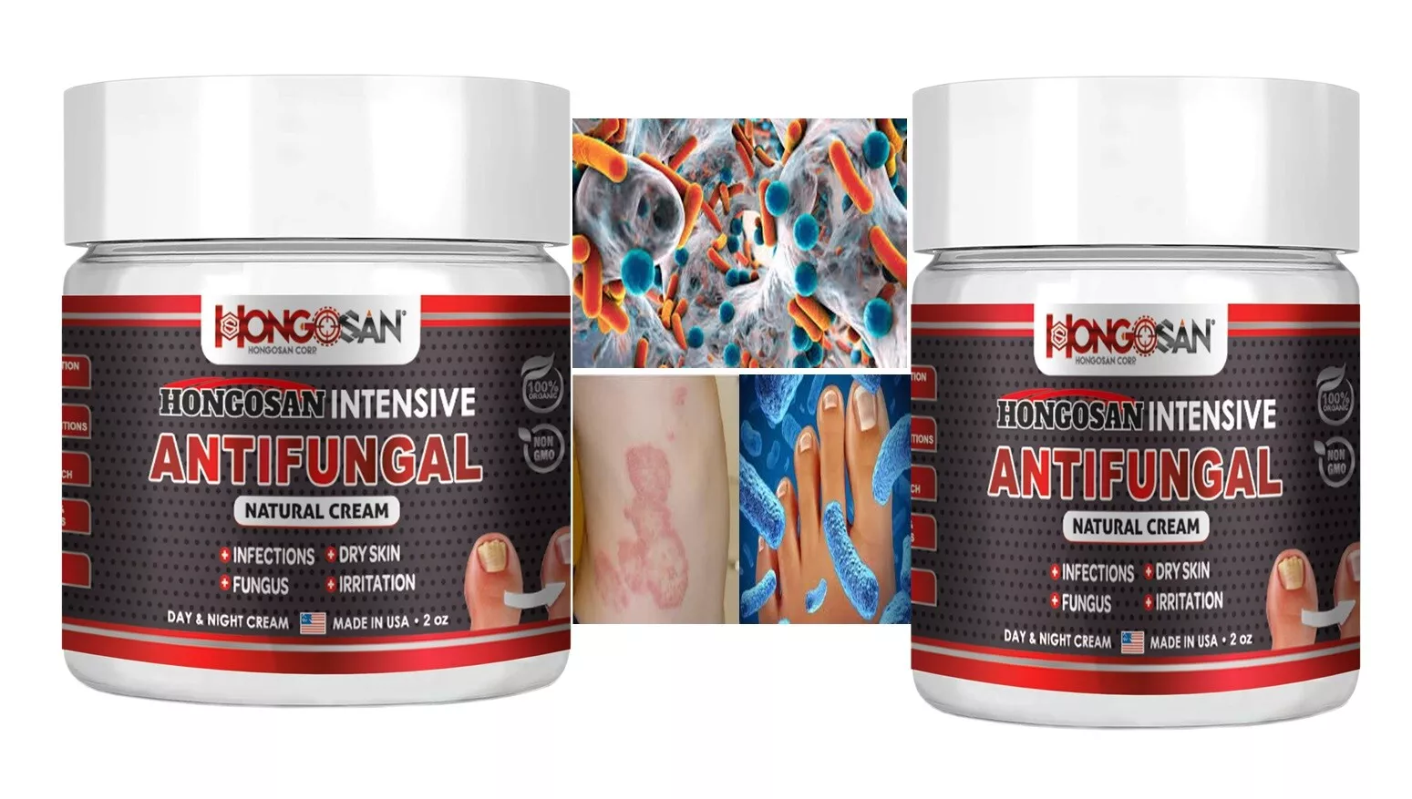 Toenail Antifungal cream athlete's foot nail hongos pies - Walmart.com
