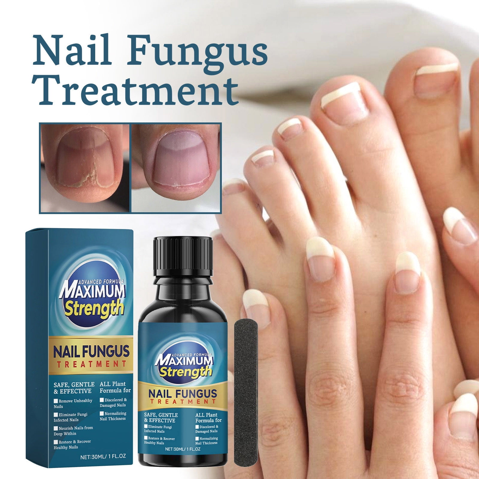 Toenail Extra Strength For Toenail Fingernails Nail For Athletes Foot ...