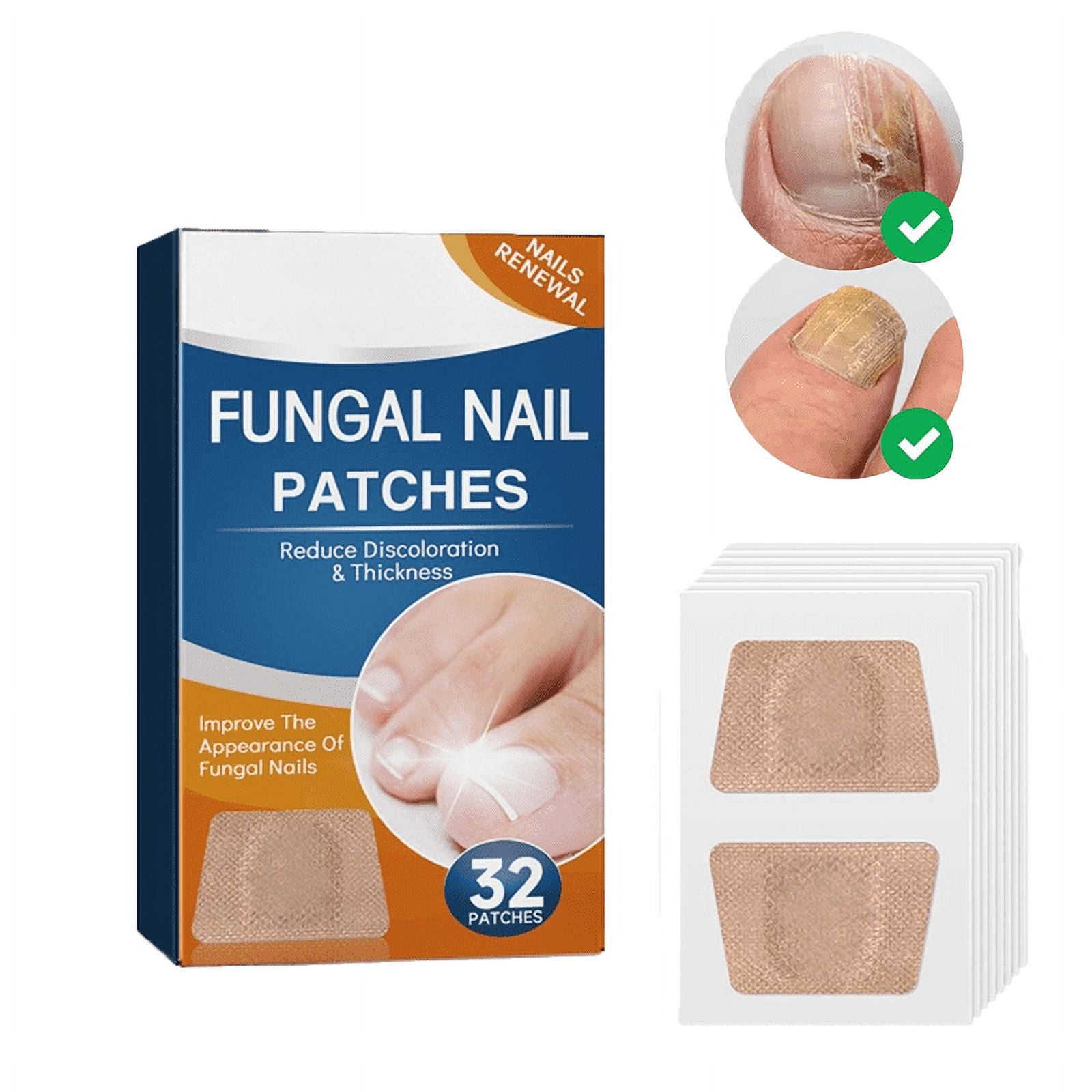 Toenail Fûngus Treatment, 32Pcs Nail Repair Patches, Nail Repair ...