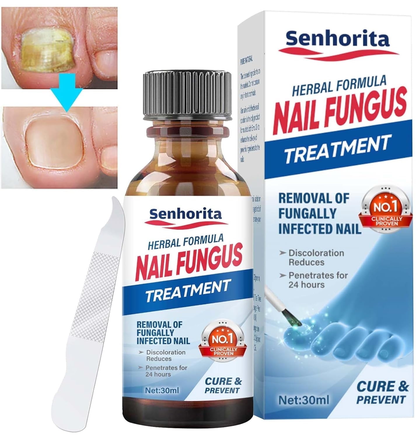 Extra Strength Antifungal Nail Repair Liquid, Treatment for Damaged ...