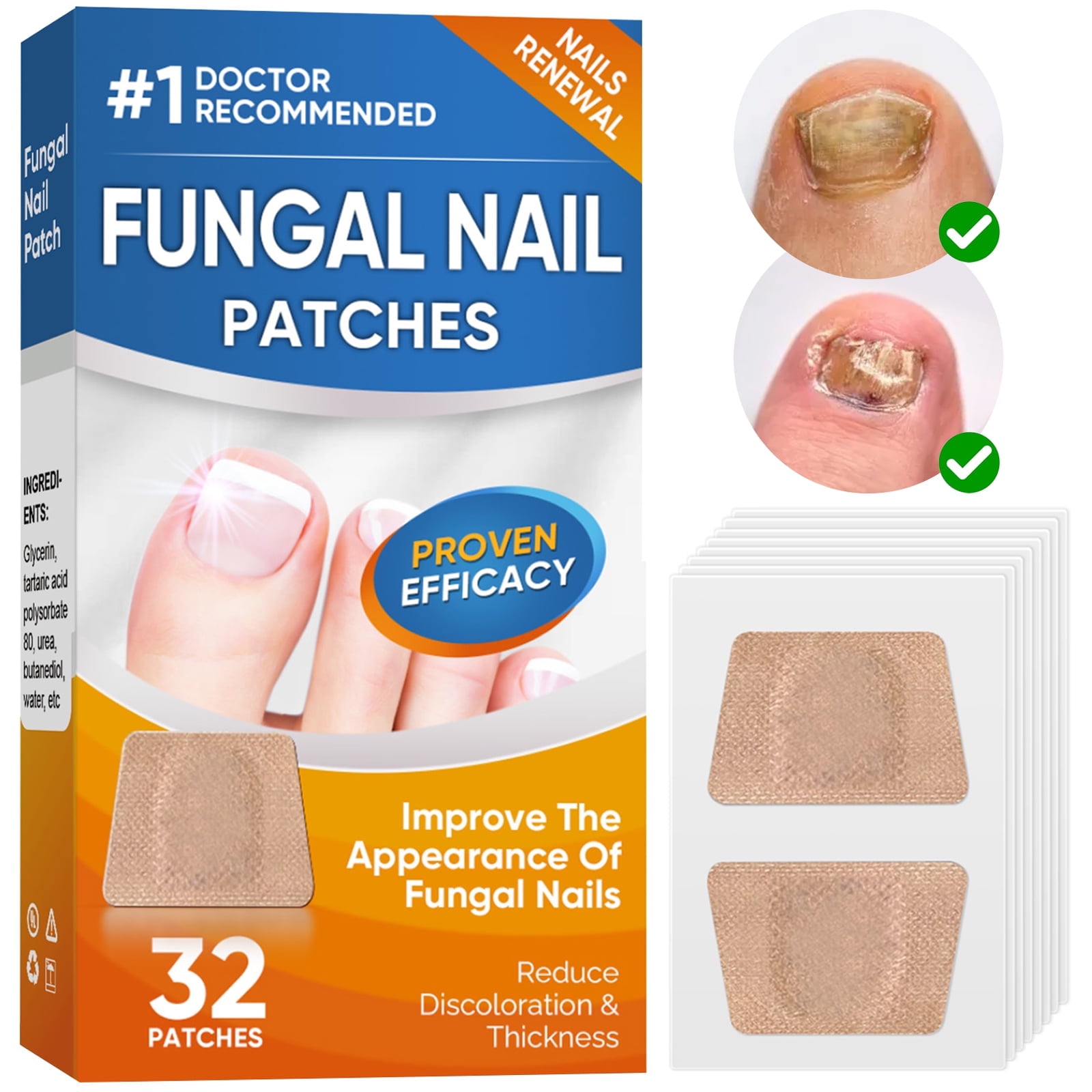 Toenail Fungus Care: 32pcs Extra Strength Treatment, Nail Repair Strips ...