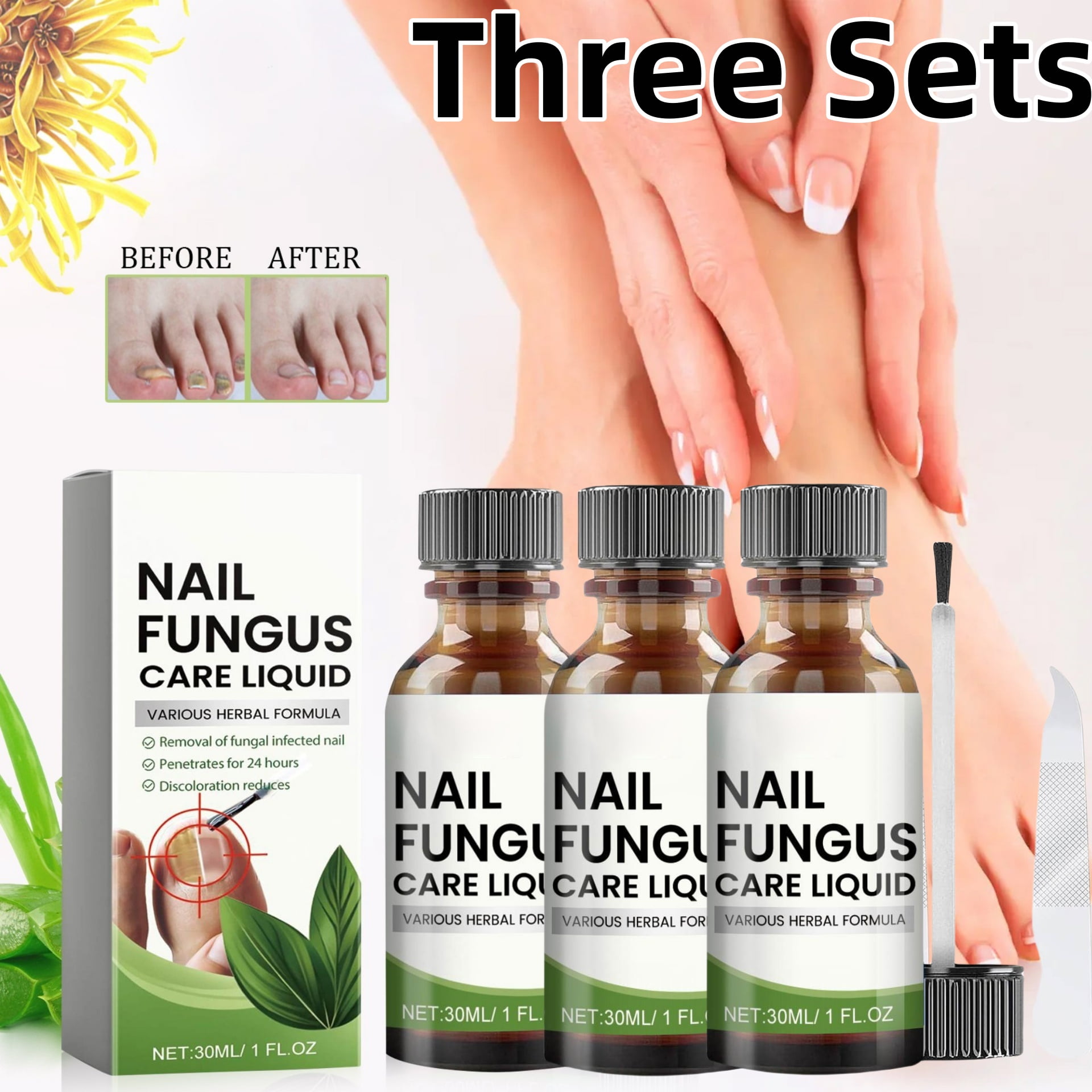 Toenail Fungus Treatment, Extra Strength Nail Fungus Solution for ...