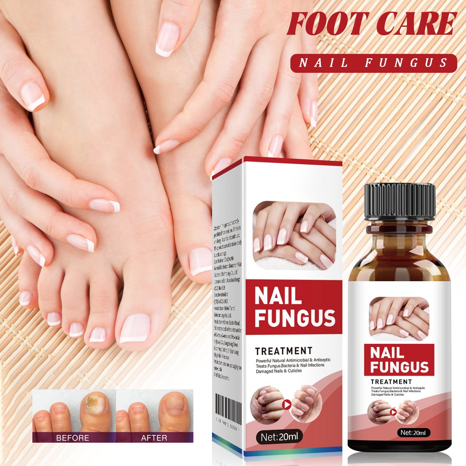 Toenail Fungus Treatment Extra Strength, Nail Fungus Treatments for Toenail & Fingernails ...