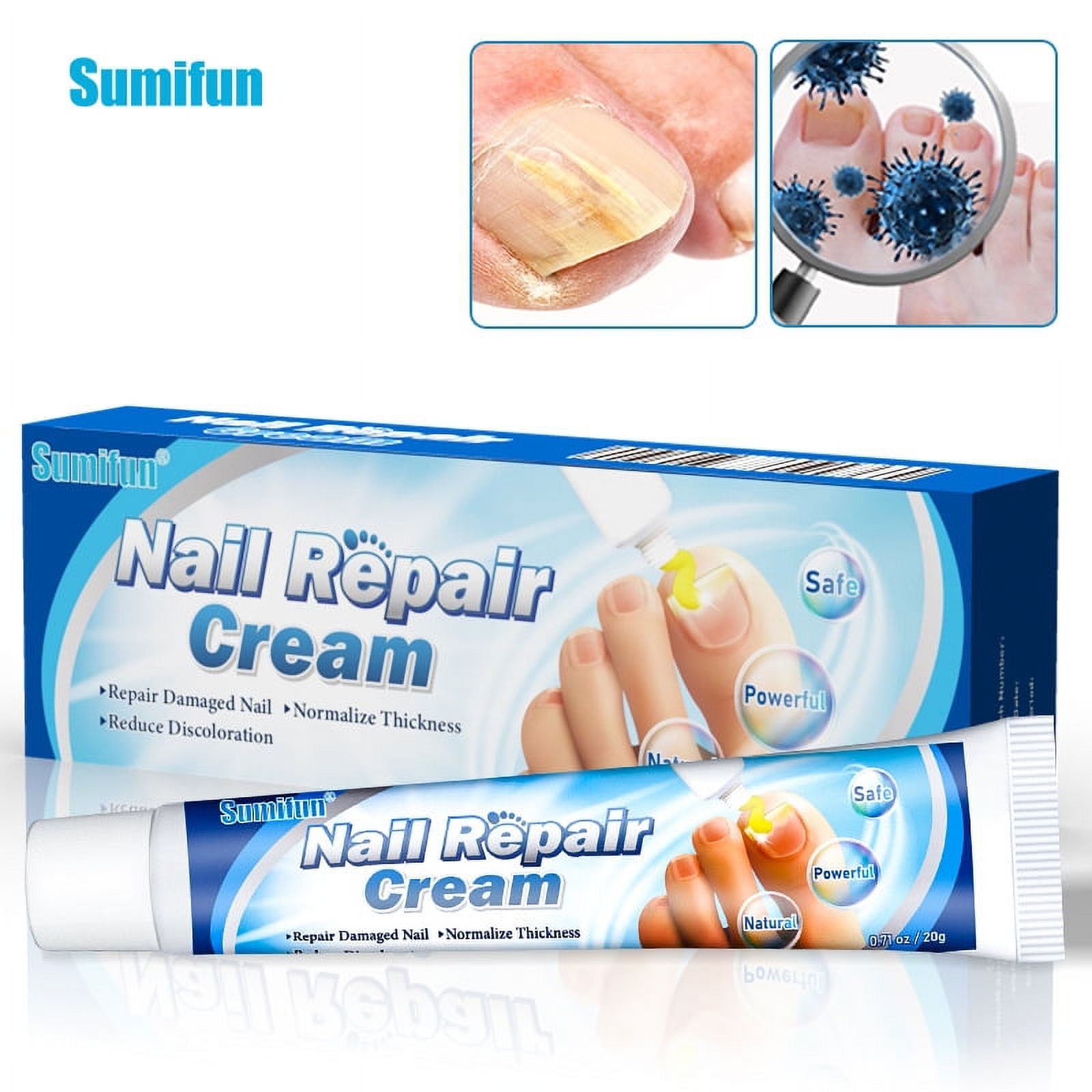 Toenail Fungus Treatment, Nail Repair Cream, Toe Nail Treatment Extra ...