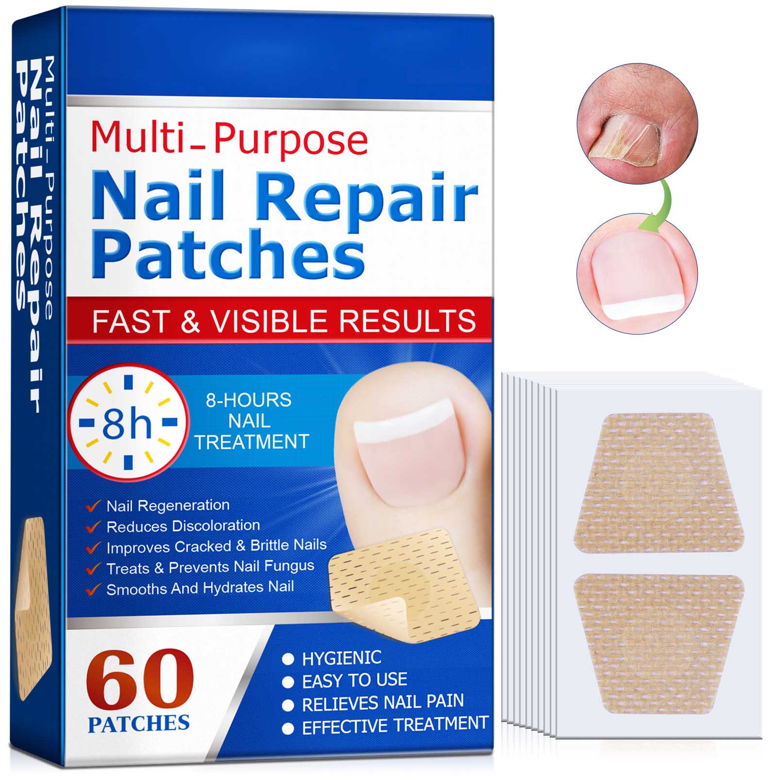 Toenail Fungus Treatment,Nail Repair Liquid for Toenail and Fingernail ...