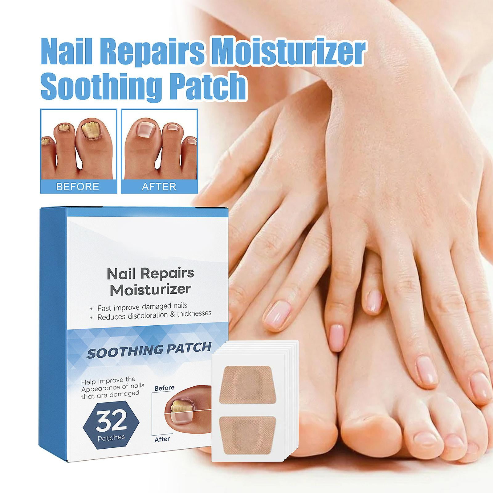 Toenail Fungus Treatment, Renewal Fungal Nail Patches, Overnight Nail ...