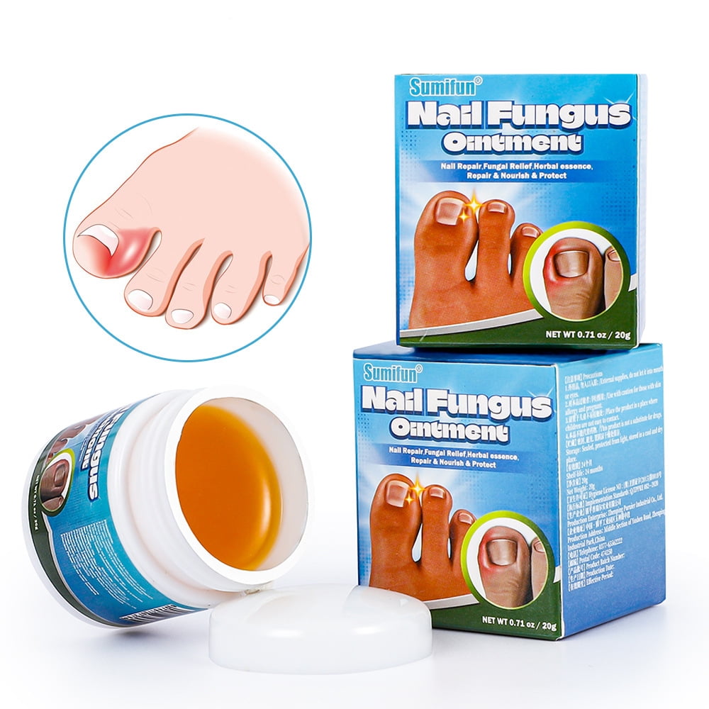 Toenail Onychomyia Repair Cream, Toe Be Health Instant Beauty Gel ...
