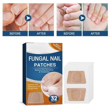 Opti-Nail™ Fungal Nail Renewal Patches, Night-Time Nail Treatment, 21 ...