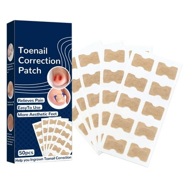 50Pcs Ingrown Toenail Correction Stickers Nail Corrector Patches Nail ...