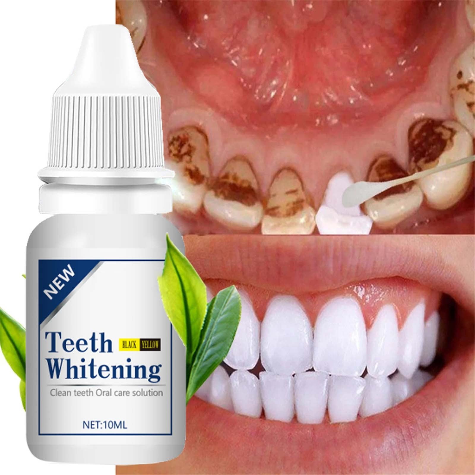 Tooth Care Teeth Oral Hygiene Cleaner Whiten Bleach Whitener Plaque ...