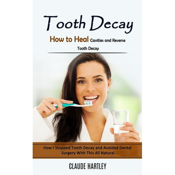 Tooth Decay: How to Heal Cavities and Reverse Tooth Decay (How I ...