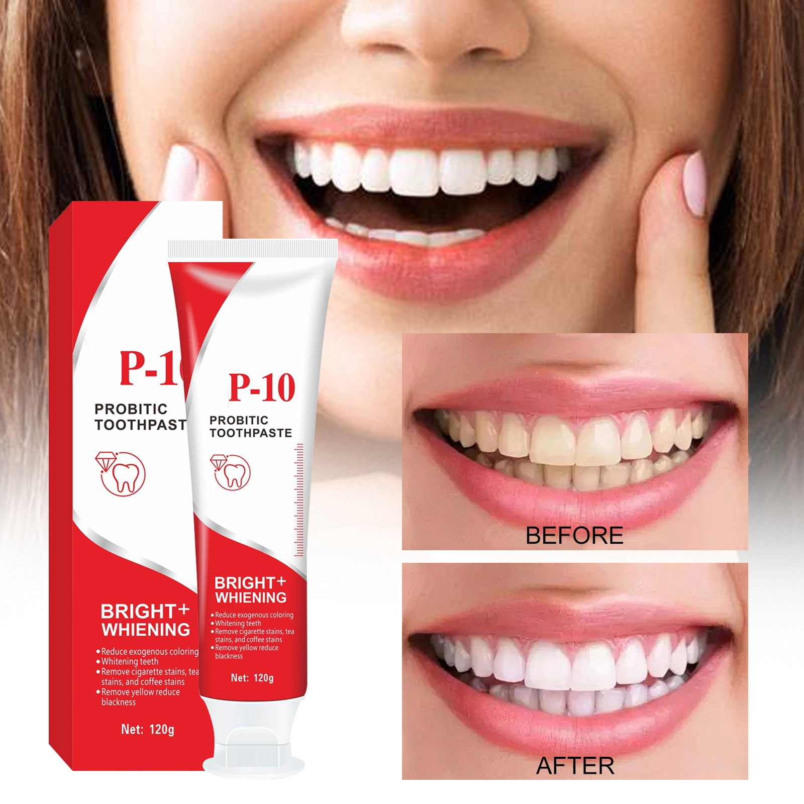 Tooth Pastetooth Paste Whitening Probiotic Toothpaste, Mild Natural Ingredient Toothpaste, Fresh ...