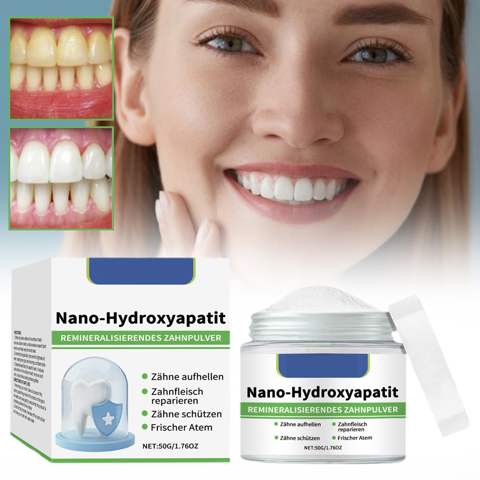 Tooth Powder – Natural Teeth Stain Remover & Gum formula for Fresh ...