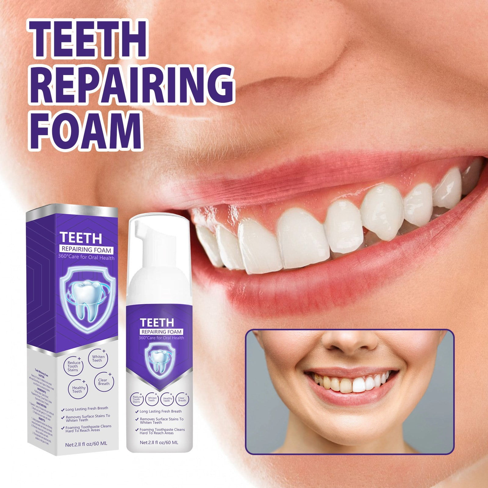 Toothpaste Cap Stand up All past on My Account Desensitizing Toothpaste ...