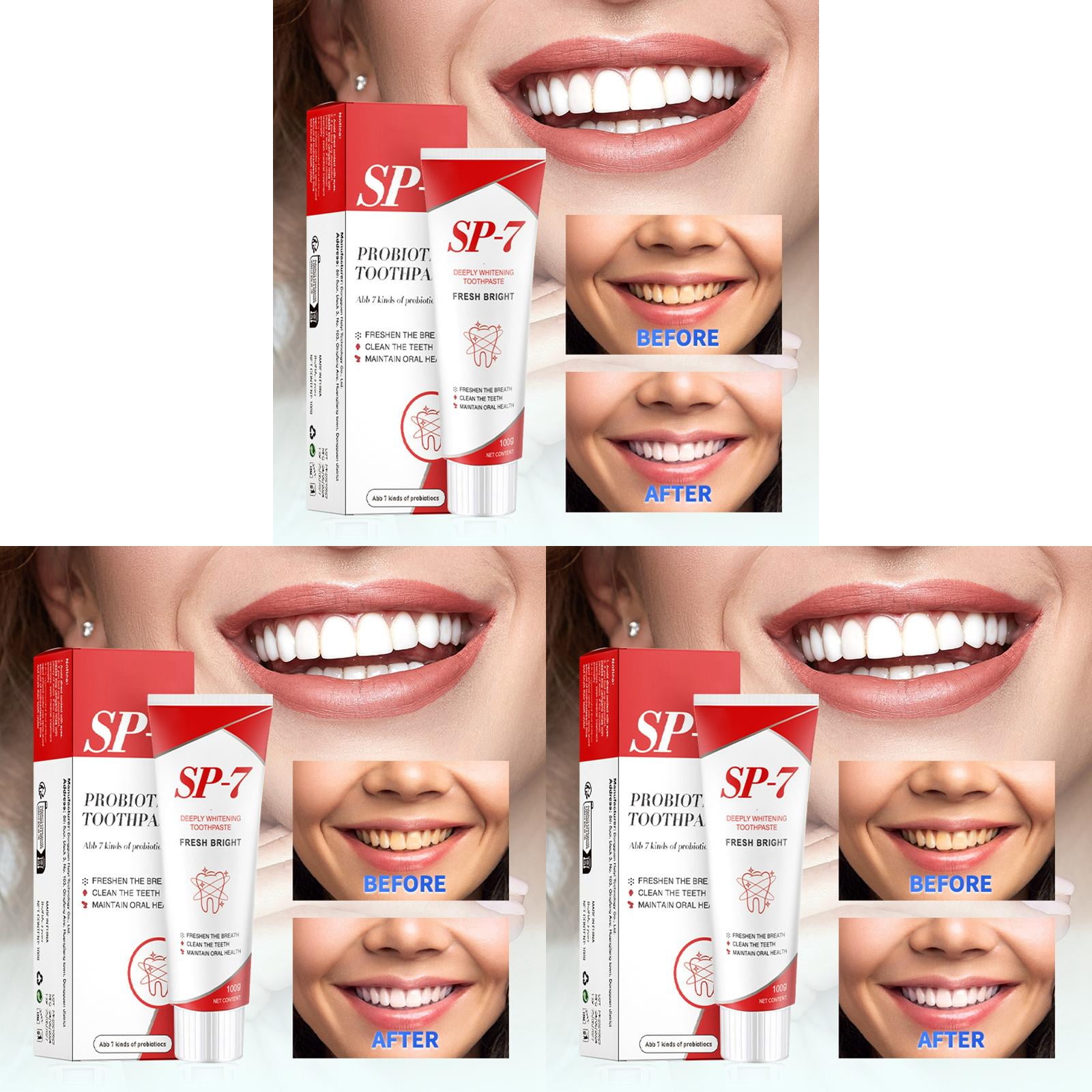 Toothpaste Ultra Toothpaste Sp 6 Toothpaste Deep Cleansing Toothpaste ...