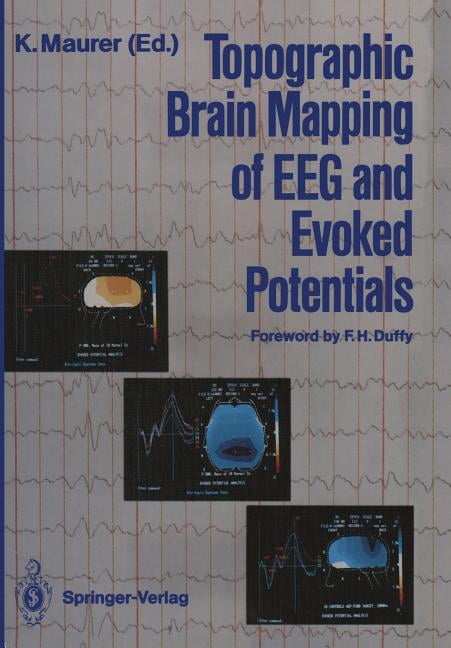 Topographic Brain Mapping of Eeg and Evoked Potentials, (Paperback ...
