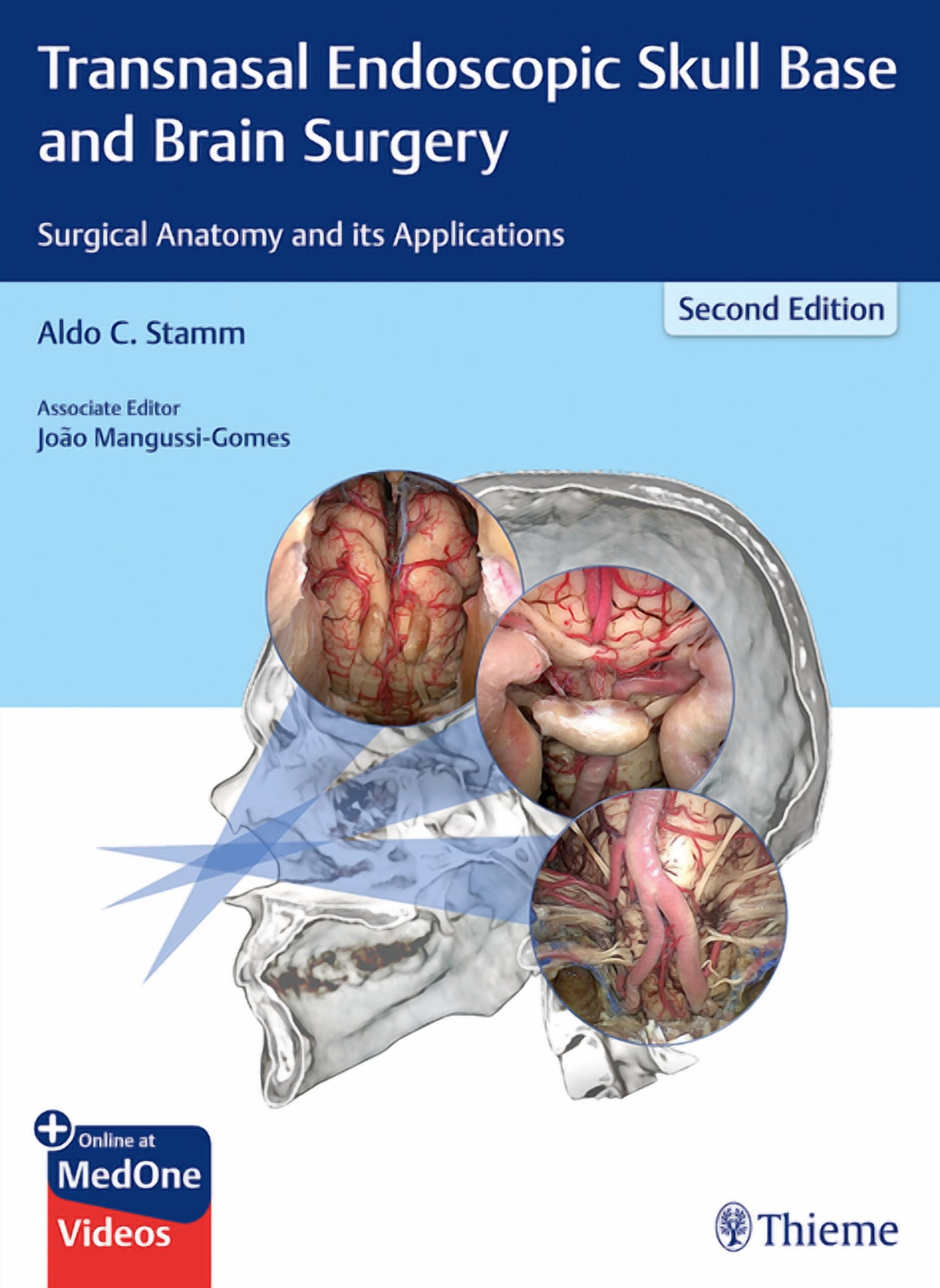 Transnasal Endoscopic Skull Base and Brain Surgery: Surgical Anatomy ...