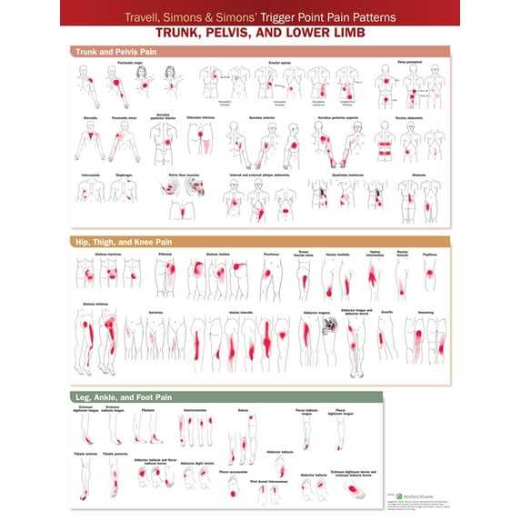 Travell, Simons & Simons' Trigger Point Pain Patterns Wall Chart: Trunk ...