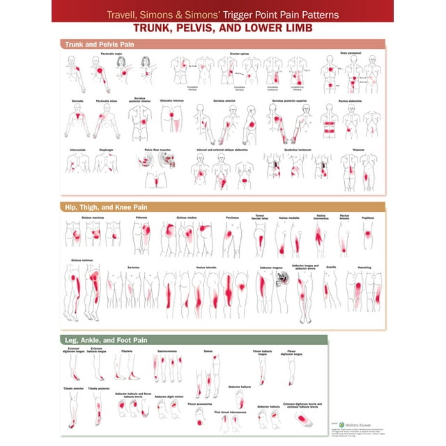 Travell, Simons & Simons' Trigger Point Pain Patterns Wall Chart: Trunk ...