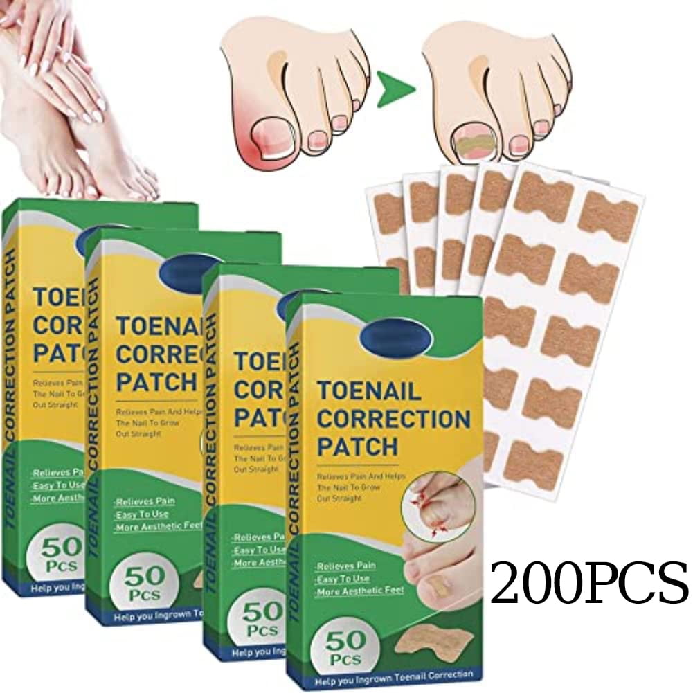 Treatment Ingrown Toenail Corrector Strips,Fitmedify Nail Patches with ...