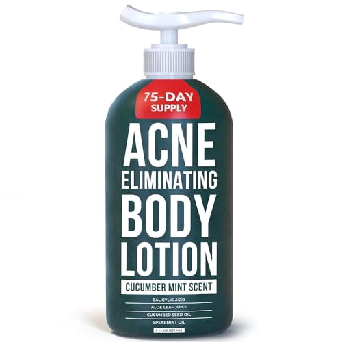 TreeActiv Acne Eliminating Body Lotion, 8 fl oz, Salicylic Acid Lotion ...