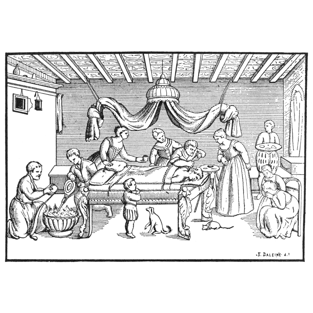 Trephining 16Th Century. Na Surgeon Trephining The Skull Of A Patient ...