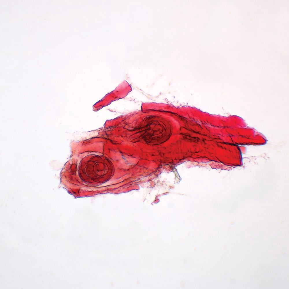 Trichinella Spiralis Encysted Larvae Slide, W.M. - Walmart.com