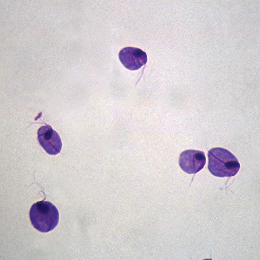 Trichomonas Vaginalis Under Microscope
