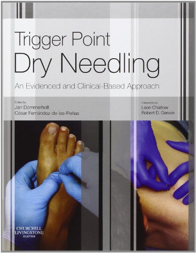Pre-Owned Trigger Point Dry Needling: An Evidence and Clinical-Based Approach, 1e Hardcover ...