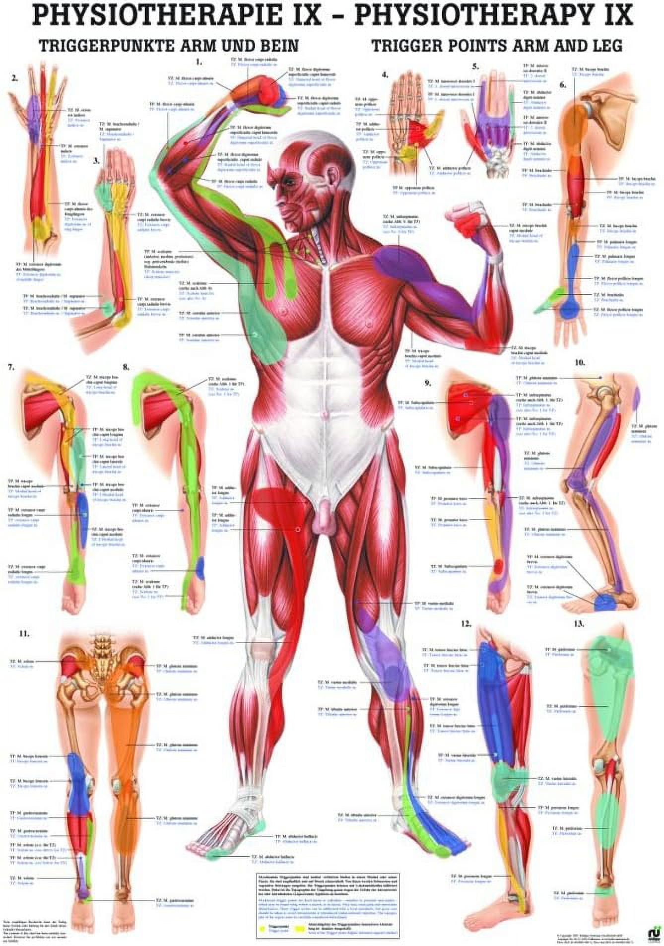 Trigger Points: Arms and Legs Laminated Chart - Walmart.com