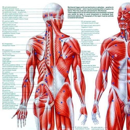 Trigger Points Laminated Chart - Walmart.com