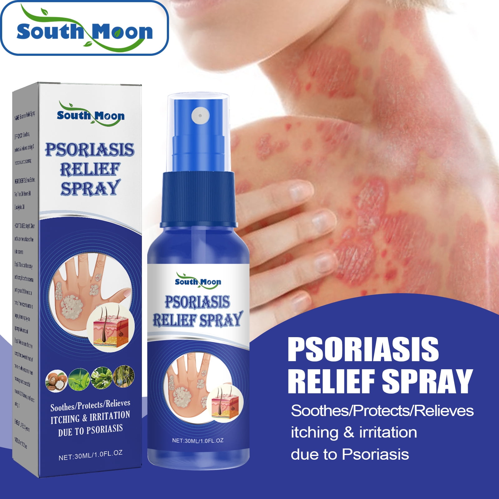 Trosgynnu Psoriasis soothing spray, tinea pedis repair skin itching and ...